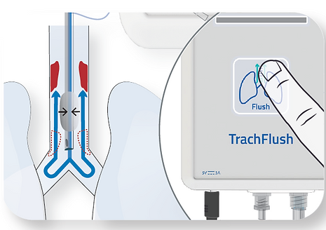 Flush Control | TrachFlush